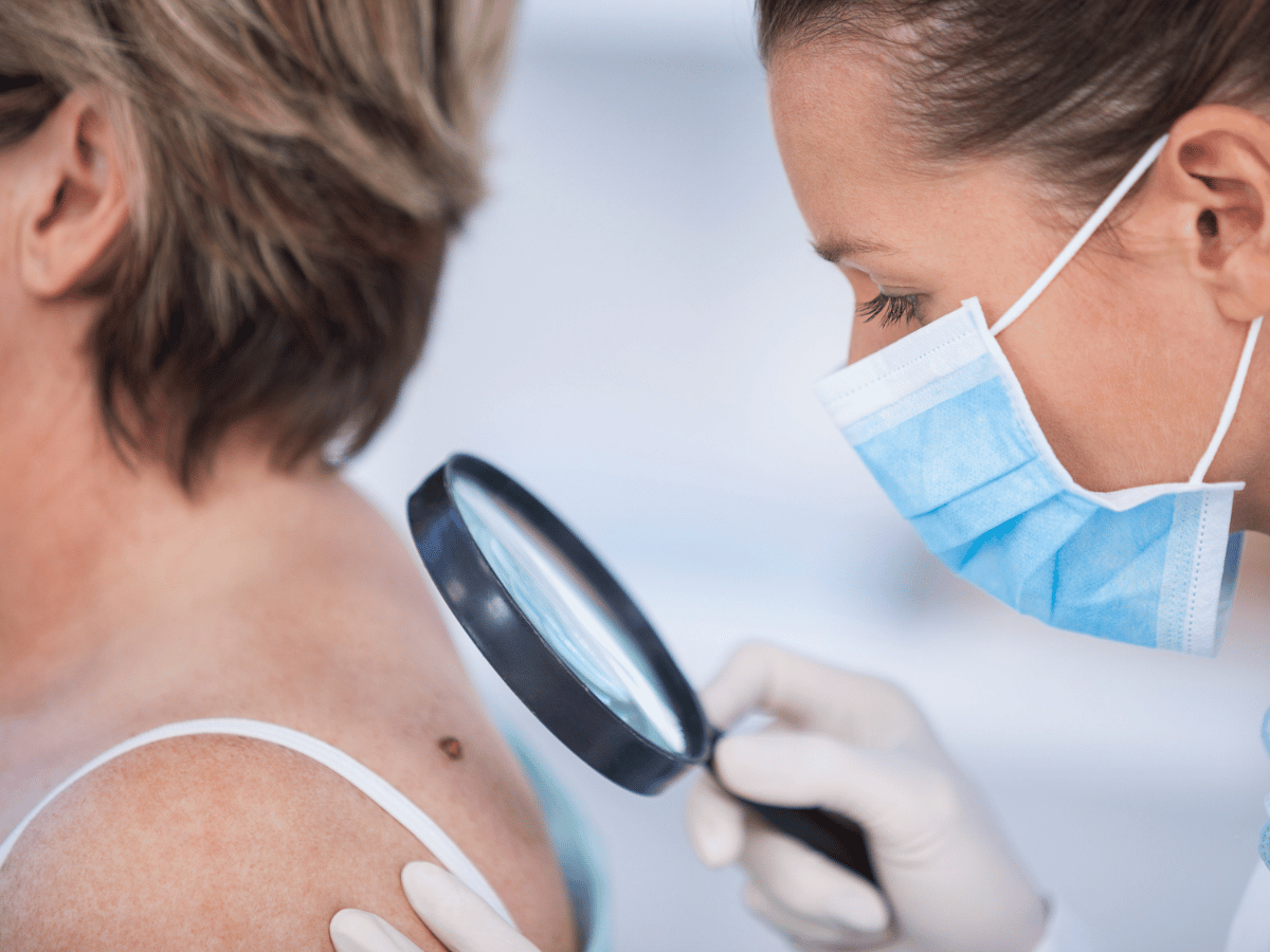 Skin Cancer - Maryland Dermatology Laser, Skin & Vein Institute